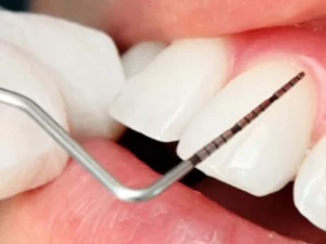 DLEprep – Saudi Dental Licensure Examination SDLE